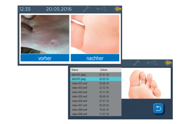 Azuras Chrome – hadewe